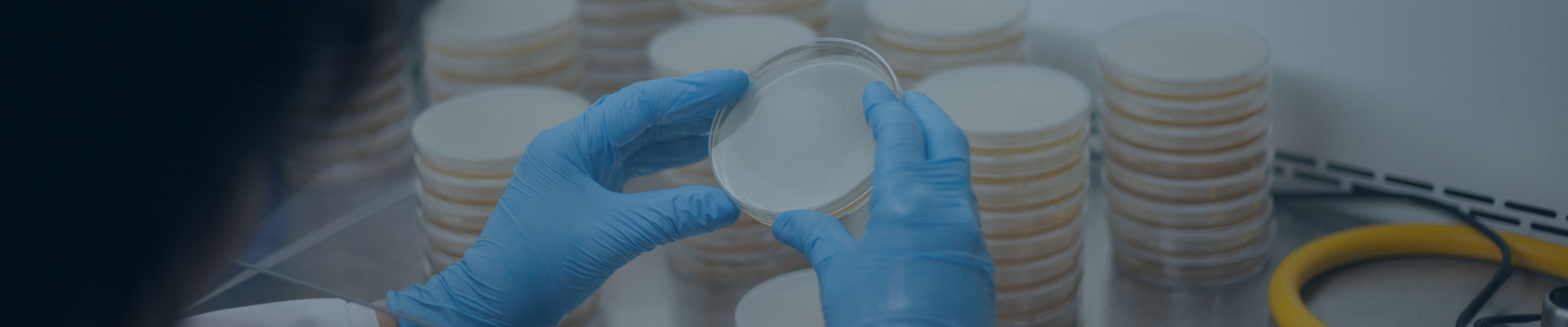 The use of Antimicrobial Effectiveness Testing in Pharmaceutical ...